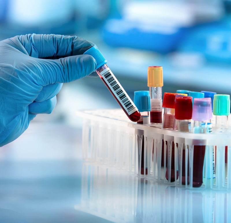 Laboratory | Palestine Regional Medical Center